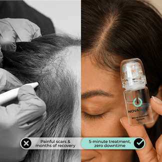 NovaMane Hair Regrowth Micro-Infusion System For Women
